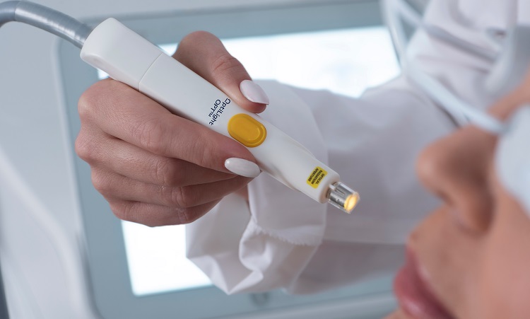 OptiLight by Lumenis - Treasure State Eye Care